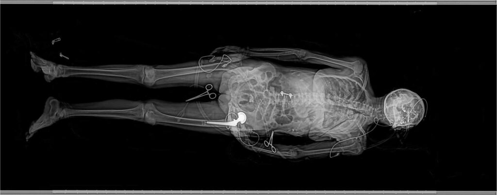 FOBOS XRS · Shielded forensic radiography system